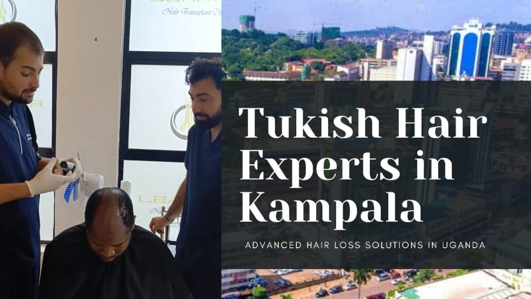 Turkish Hair Experts Open in Kampala with Affordable Transplants - The ...